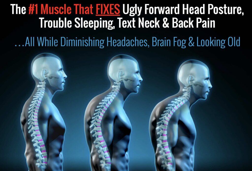 Forward Head Posture Fix Reviews – (I've Tested) My Honest Experience ...